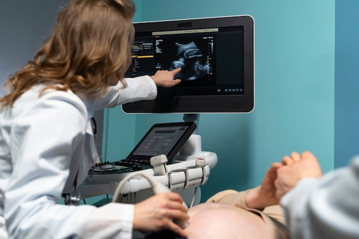Échographie de datation : Guide complet pour les futurs parents - Une ...